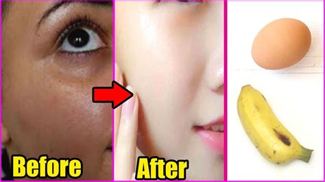 Amazing Look 18 Years Younger Using Banana And Egg White Asian Anti