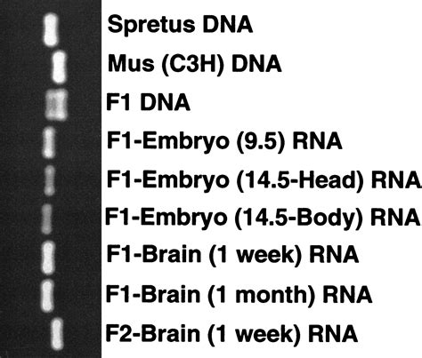 Discovery Of A Novel Paternally Expressed Ubiquitin Specific