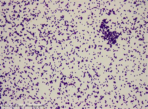 Microscope S Epidermidis Gram Stain Micropedia