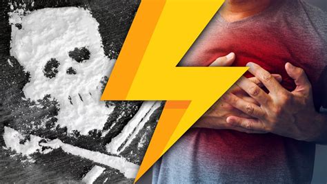lightning learning basic chest x rays in adults — em3 east midlands