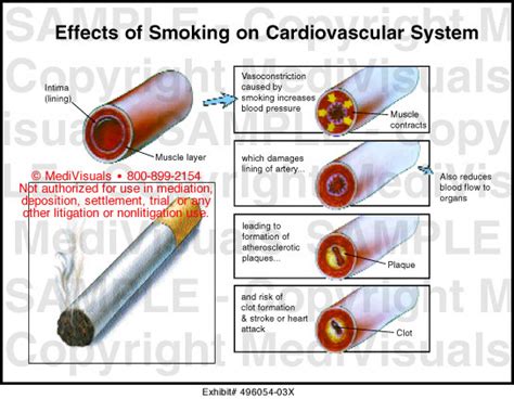 Effects Of Smoking On Cardiovascular System Medical Exhibit