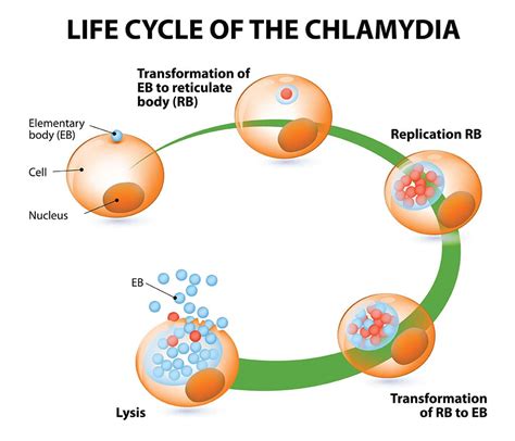 Chlamydia The Silent Sti You Didnt Even Know About Ck Birla Hospital