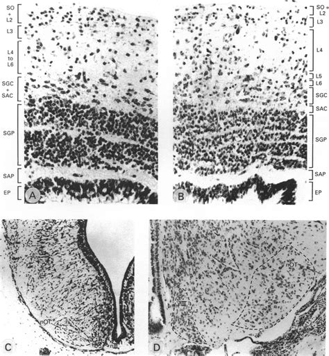 Differentiation Of The Tectum And Tegmentum A Tectum Stage 20 The