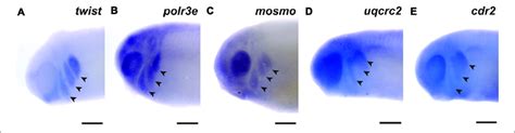 16p12 1 Affected Genes Are Expressed In Migrating Neural Crest Cells