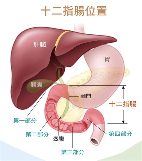 十二指腸潰瘍 手術 詳細