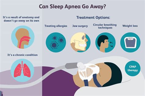 How To Reduce Sleep Apnea Snoring At Gloria Garcia Blog