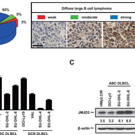 The Jmjd3 Irf4 Axis Mediates The Anti Apoptotic Effect Via Nf κb Signal