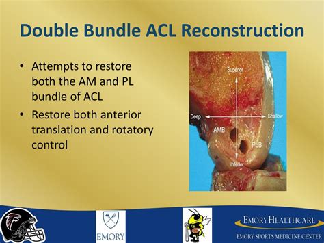Ppt Acl Reconstruction The Anatomic Approach Powerpoint Presentation