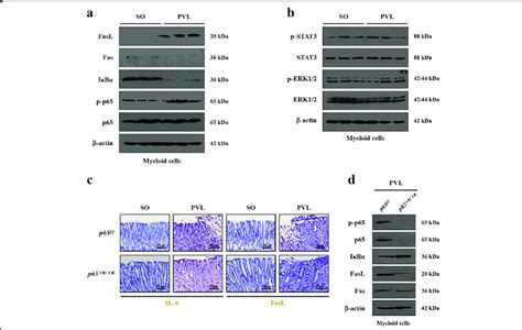 Il 6 Upregulated Fasl Levels Via Nf κbp65 In Myeloid Cells In Phg A