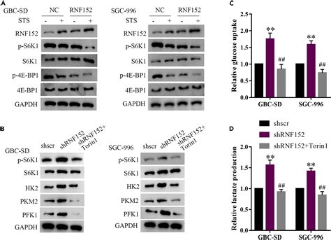 Fasting Induced Rnf152 Resensitizes Gallbladder Cancer Cells To