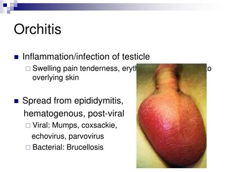 Ppt Urolithiasis Syndrome Of Swollen Scrotum Powerpoint