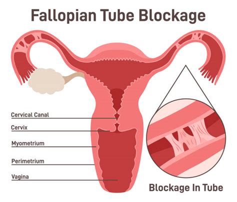 80 Pelvic Floor Anatomy Stock Illustrations Royalty Free Vector