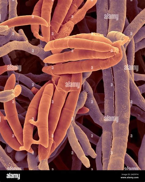 Coloured Scanning Electron Micrograph Sem Of Filamentous Fungus