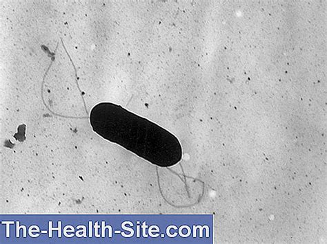 Listeriosis Síntomas Causa Y Tratamiento 💊 Científico Práctico