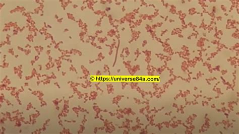 Enterobacter Introduction Morphology Pathogenicity Lab Diagnosis