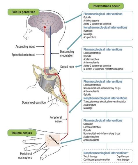 Image result for Pain Management Pathways