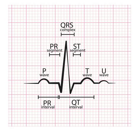 Image result for PR Interval ECG