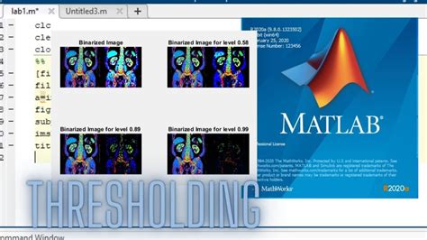 Image result for Thresholding MATLAB