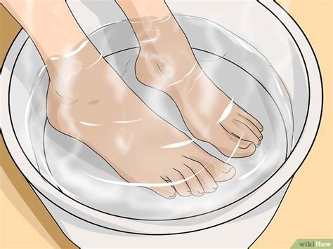 Image result for How to Remove Calluses Forever