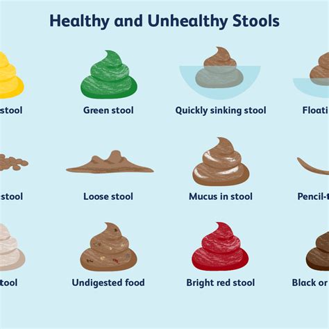 Image result for Feces Color Guide