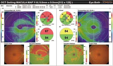 Image result for Oct Check
