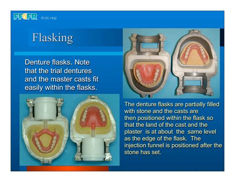 Image result for How to Process a Denture