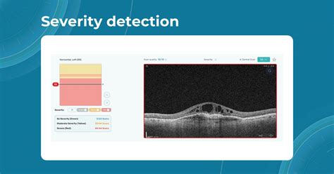 Image result for Oct Interpretation