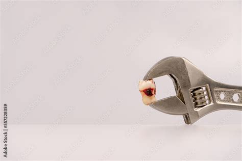 Image result for Tooth Extraction Clamp