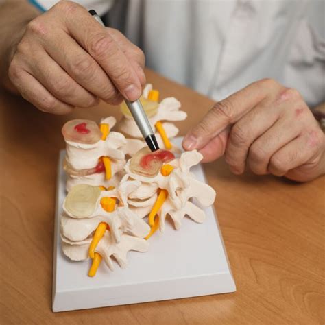 Image result for ACDF Surgery Is Serious