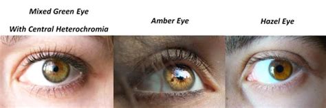 Image result for Eye Color Examples