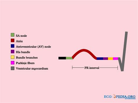 Image result for 300Ms PR Interval