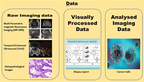 Image result for Class Data Definition