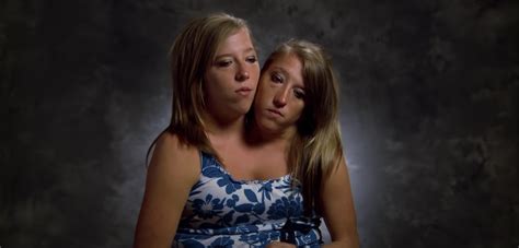 Image result for Java Island Siamese Twins