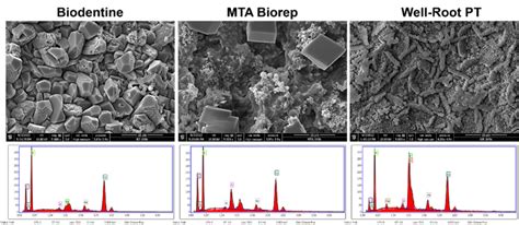 Image result for Scanning Electron Microscope Magnification