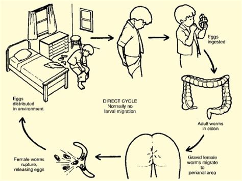 Image result for Pinworm Tape Test Procedure