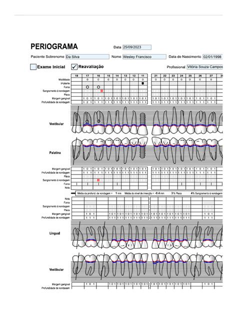 Image result for How to Read a Perio Chart