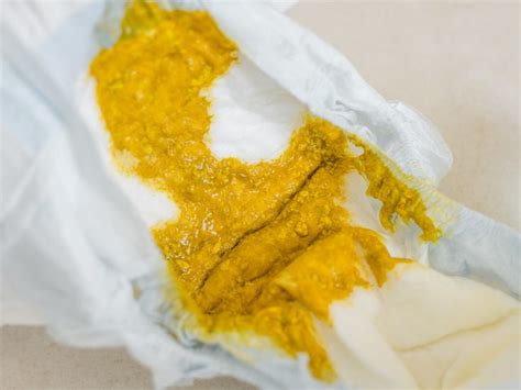 Image result for Yellow Stool Poop