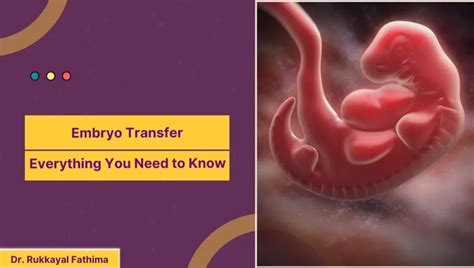 Image result for Watch Embryo Transfer