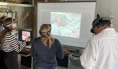 Image result for Human Brain Dissection