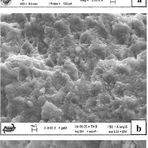 Image result for Scanning Electron Microscope Magnification