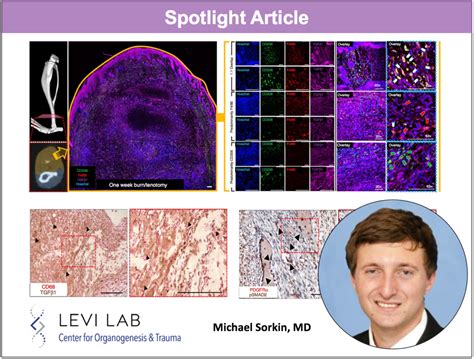Image result for Types of Abnormal Bone Formation