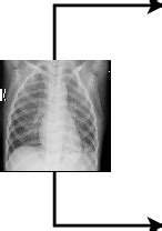 Image result for Self-Learning Algorithm