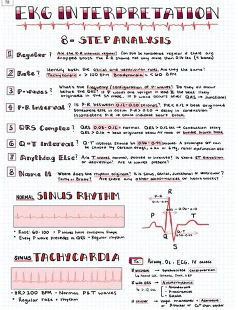 Image result for ECG Step by Step