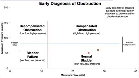 Image result for How Does a Urocuff Work