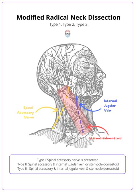 Image result for Types of Neck Dissection