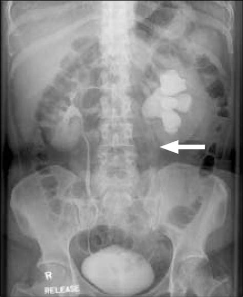 Image result for Urogram Exam