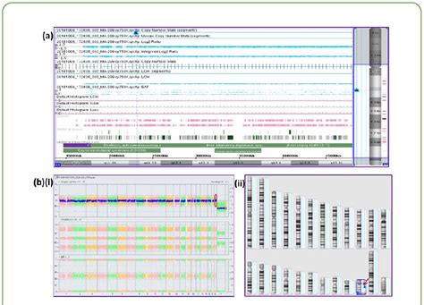Image result for Duplication Chromosome Microarray