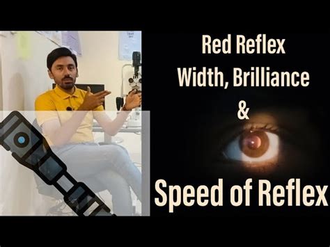 Image result for Red Reflex