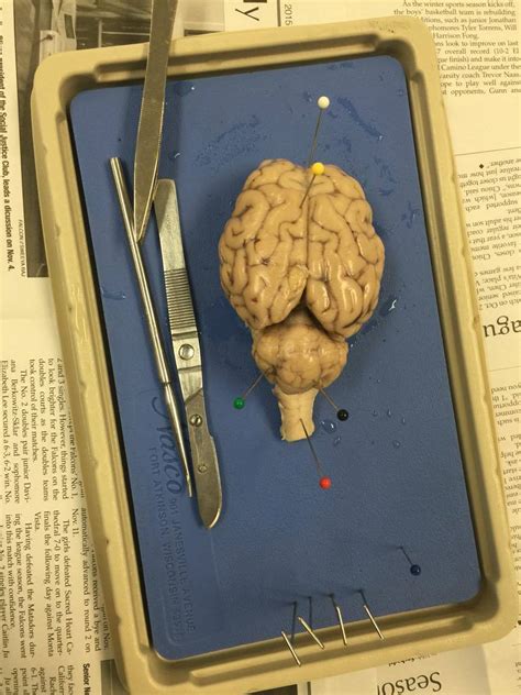 Image result for Brain Dissection