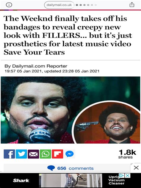 Image result for The Weeknd Botox